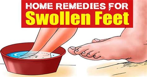 How To Reduce Swelling In Feet And Ankles