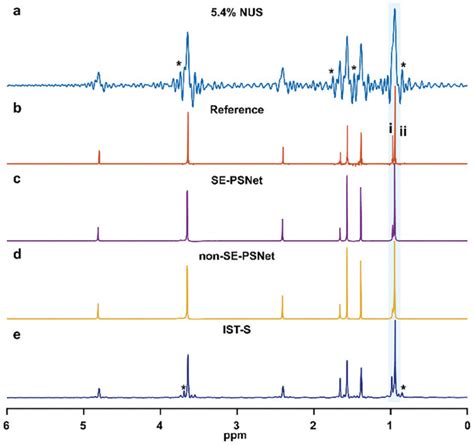 Fast Pure Shift Nmr Spectroscopy Using Attention‐assisted Deep Neural Network Zhan 2024
