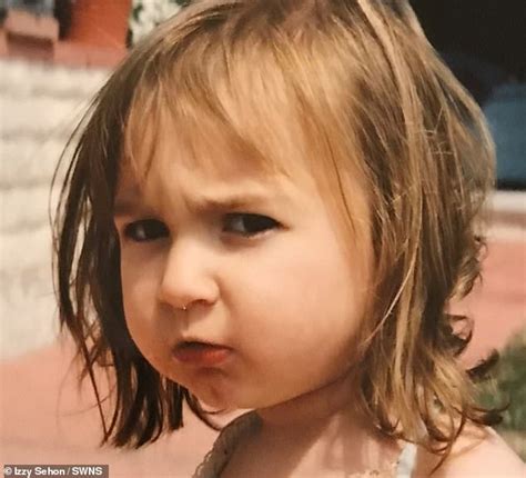 I Was Bullied For Looking Like A Squirrel So I Underwent 200k Surgery