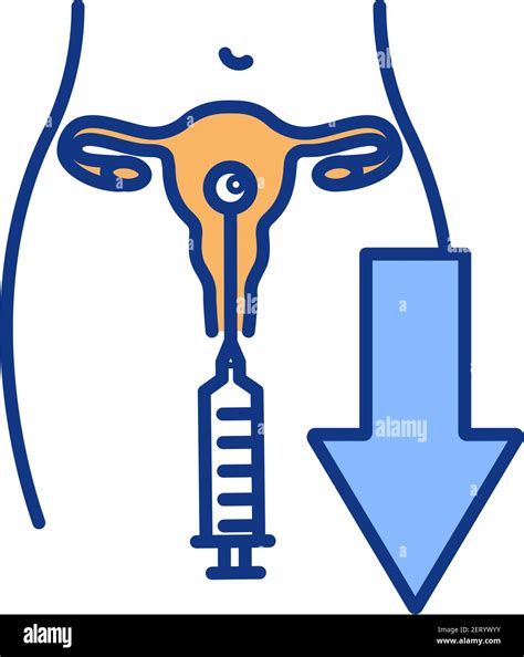 Egg Retrieval Technique Rgb Color Icon Stock Vector Image And Art Alamy