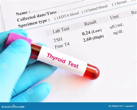Abnormal Thyroid Hormone Result Stock Image Image Of Care Tube 290261197