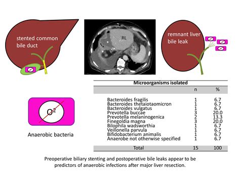 Anaerobic Bacteria Diagram
