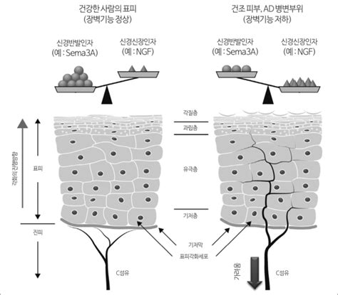 Cjk 2022년 1월호 특집 가려움과 건조한 피부 2