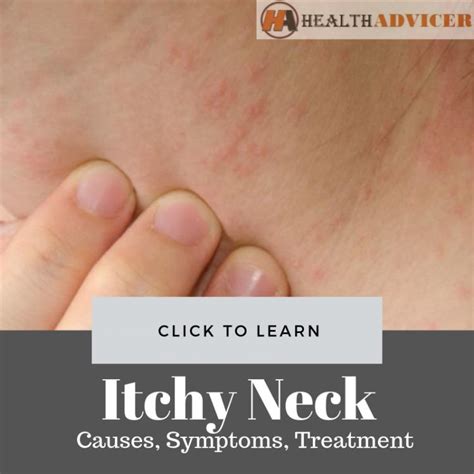 Itchy Rash On Neck Autoimmune Disease At Cindy Larson Blog