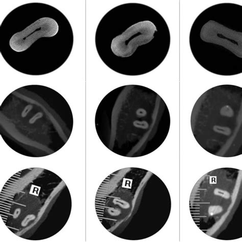 Distribution Shows The Teeth And Sites With Root Anomalies Download