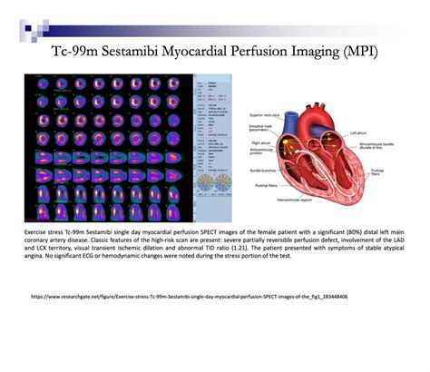 Spect Single Photon Emission Computed Tomography At Best Price In Lucknow