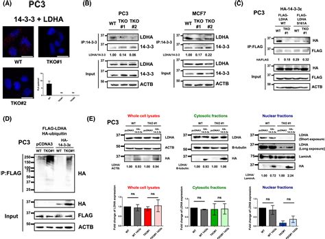 Pim Kinases Phosphorylate Lactate Dehydrogenase A At Serine 161 And