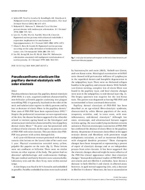 Pdf Pseudoxanthoma Elasticum Like Papillary Dermal Elastolysis