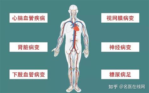 糖尿病多是吃出来的5个饮食习惯防治甜蜜人生 知乎