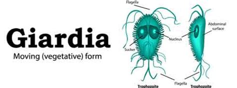 Giardiasis Beaver Fever Symptoms Causes Diagnosis