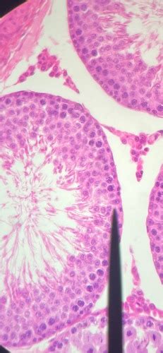 Male Reproductive Flashcards Quizlet