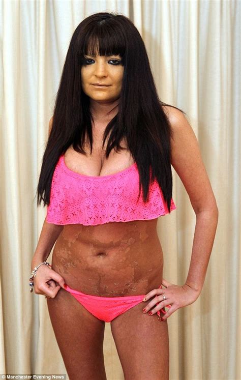 Boxing Champion Takes Out Injunction To Prevent Him Being Named In