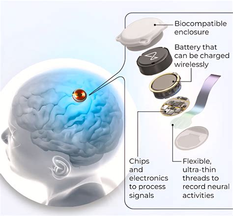Neuralink Ethical Perspective Pwonlyias