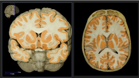 LAB Central Nervous System And Cranial Nerves Flashcards Quizlet