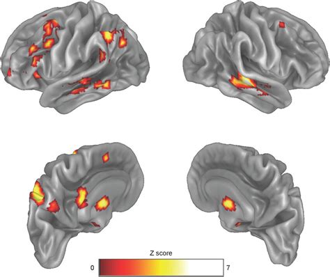 Whole Brain Analysis Map Map Represents Regions Of Significant