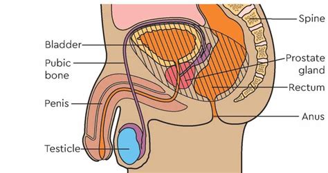 What Is Involved In A Total Pelvic Exenteration Tpe