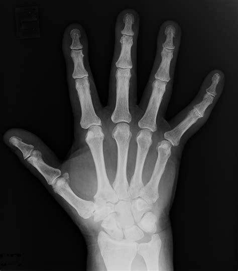 รายการ 102 ภาพพื้นหลัง ภาพ X Ray ใหม่ที่สุด