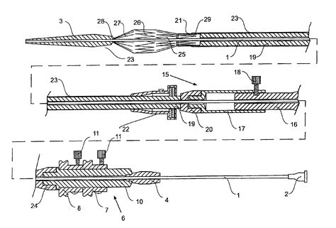 Aortic Stent Patented Technology Retrieval Search Results Eureka Patsnap