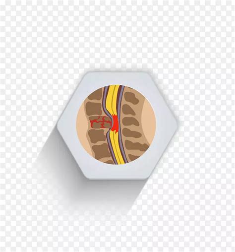 脊髓保健疾病症状png图片素材下载图片编号6360751 Png素材网