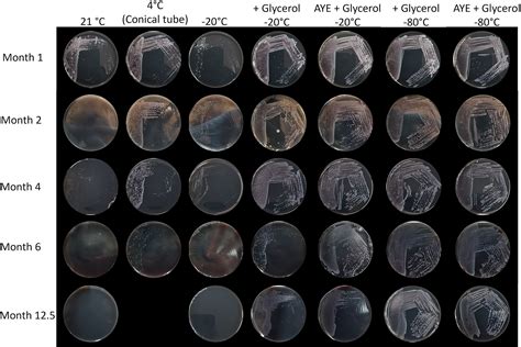 Detection Of Diverse Sequence Types Of Legionella Pneumophila By Legiolert Enzymatic Based Assay