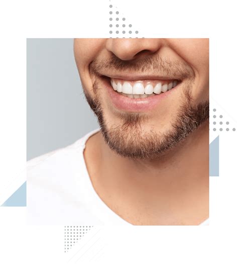 Gummy Smile Treatment • Nemeth And Katranji