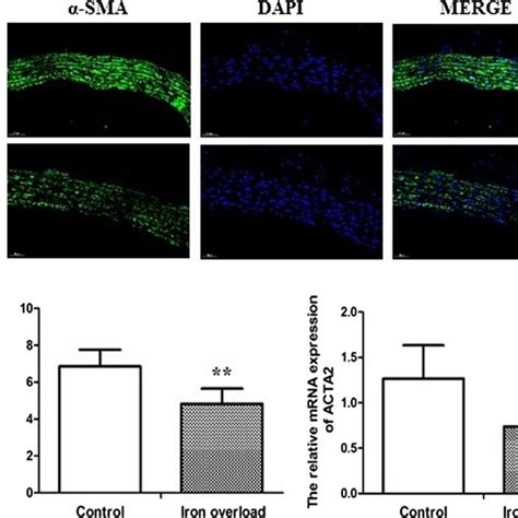 Expression Of Iron Metabolism Related Factors In Aortic Tissue Of Iron