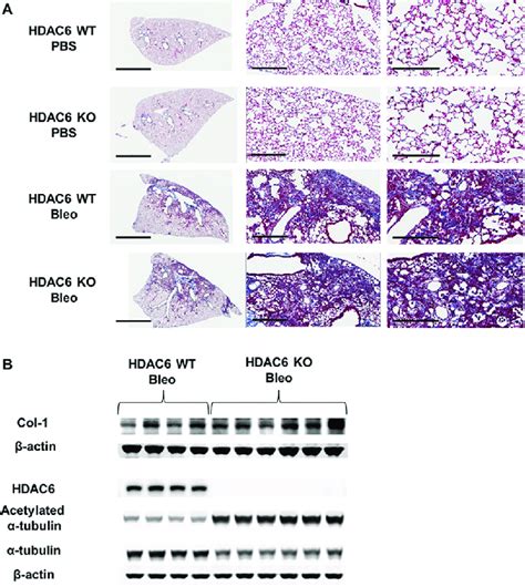 Hdac6 Knockout Mice Are Not Protected Against Bleomycin Induced