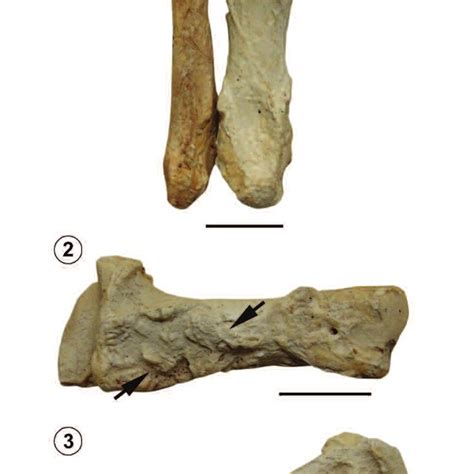 1 Metacarpal Iv Mcl 2786 01 Metacarpus V Mcl 2786 02 Proximal