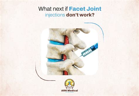 What Next If Facet Joint Injections Dont Work
