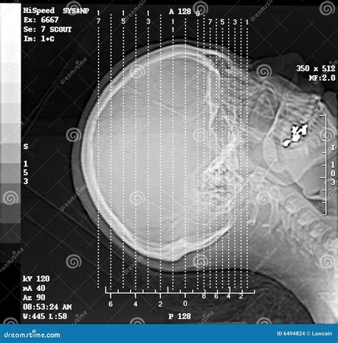 CT Scan Scout Stock Images Image