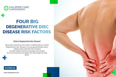 Four Big Degenerative Disc Disease Risk Factors Usa Spine Care