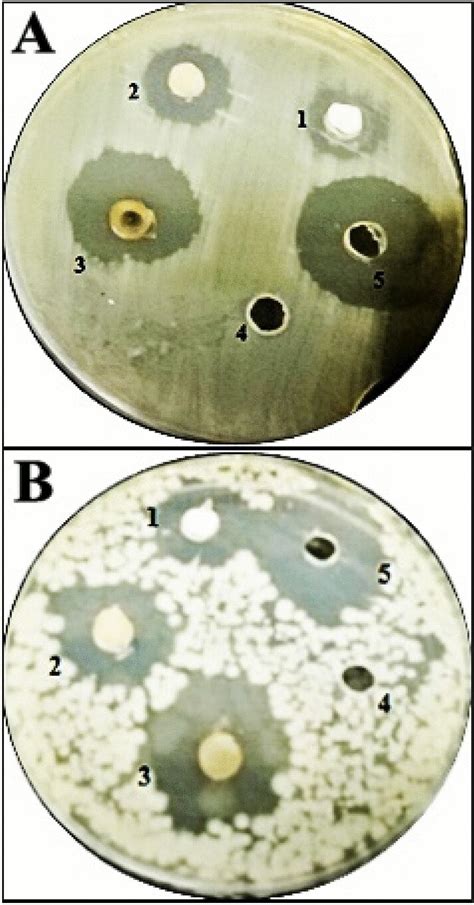 Antimicrobial Activity Of Lbgzspt Lbg And Zspt Against A S Aureus