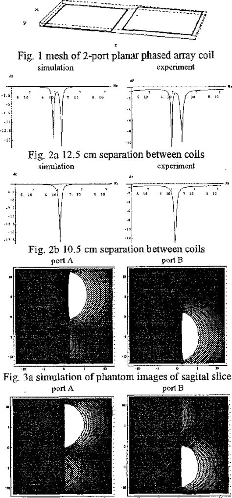 Figure 1 From Quantitative Spatialspectral Analysis Of Magnetic Resonance Imaging Surface And
