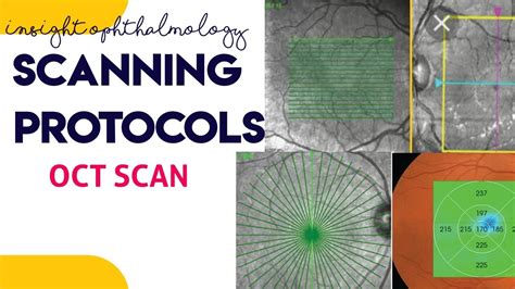 Oct Scanning Protocols Made Easy Line Scan Macular Cube Raster Scan Youtube