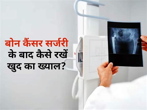 Bone Cancer Surgery बोन कैंसर सर्जरी के बाद होती है एक्स्ट्रा केयर की