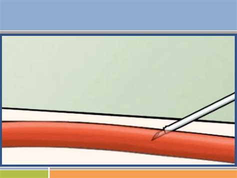 Basic Iv Catheter Placement Ppt
