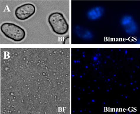 Photomicrographs Of Wild Type S Pombe Cells A And Intact Vacuoles