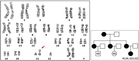 Genes Free Full Text Robertsonian Translocation Between Human