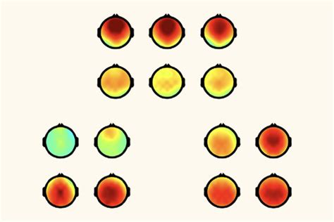 Null And Noteworthy—learning Theory Validated 20 Years Later The Transmitter Neuroscience