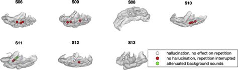 Parallel And Distributed Encoding Of Speech Across Human Auditory Cortex Cell