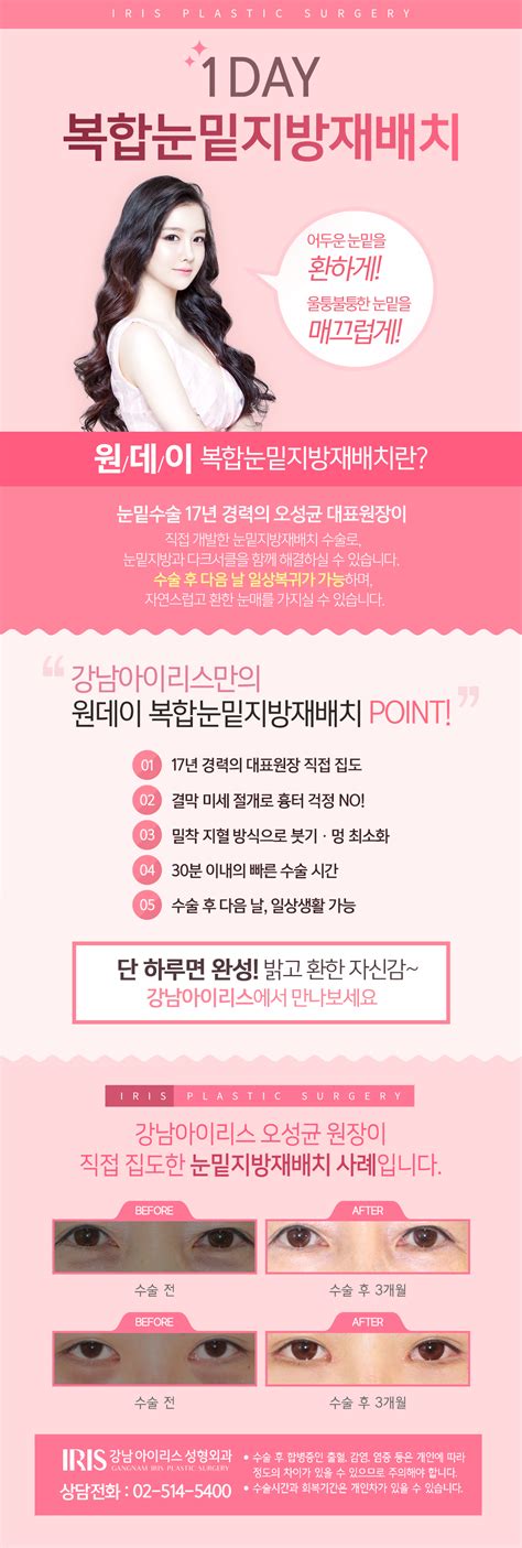 아이리스성형외과