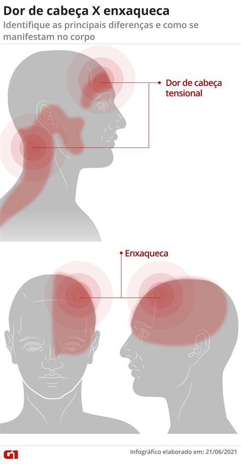 Notícias Enxaqueca X Dor De Cabeça Entenda Diferenças Tipos De