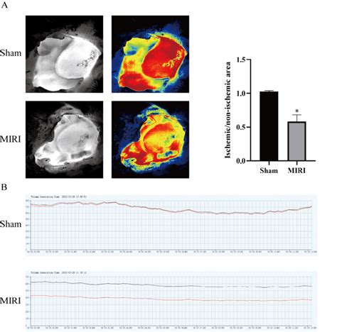 The Myocardial Ischemia Model Was Tested By Blood Flow Laser Speckle