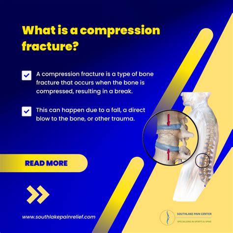Compression Fracture Symptoms And Treatment In Southlake TX South Lake Pain Center Pain