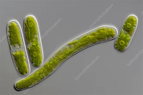 Cylindrocystis Brebissonii Algae Light Micrograph Stock Image C056