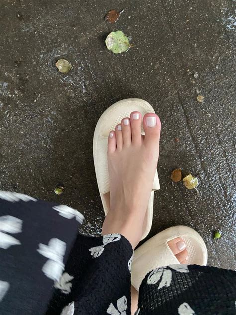 得了灰指甲怎么办？有没有好的治疗方法呀？ 知乎