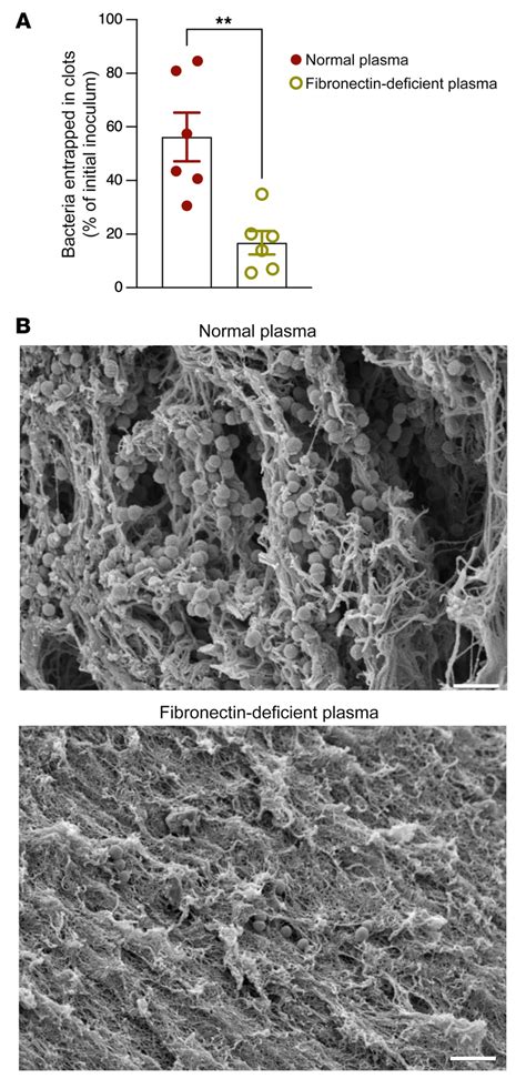 Fibronectin Is Important For Gbs Entrapment In Fibrin Clots A And B Download Scientific