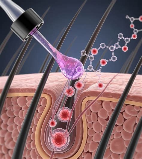 Pp405 Hair Loss Treatment Upcoming Solution For Hair Regrowth