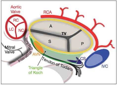 Tricuspid Valve Leaflets
