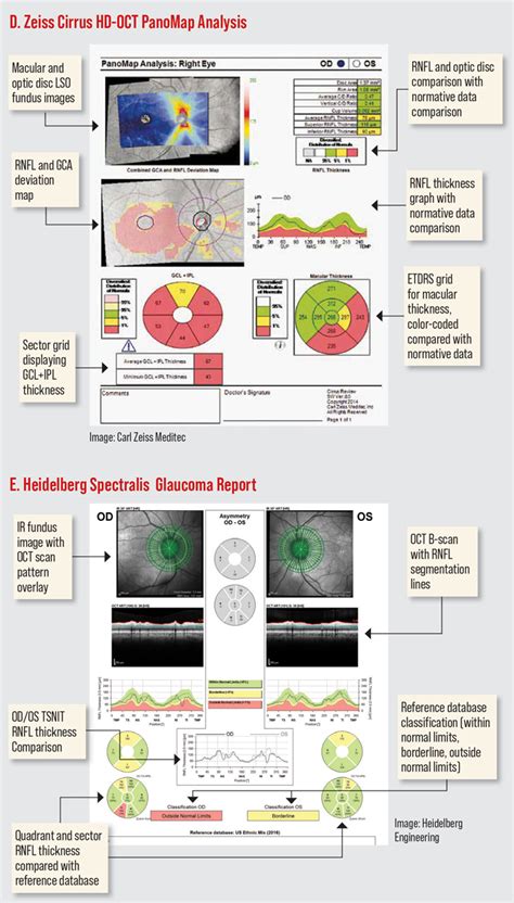 OCT Whats Under The Hood